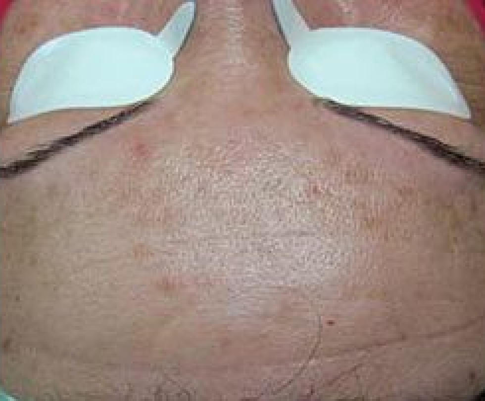 Green Toning – Refined Rejuvenation